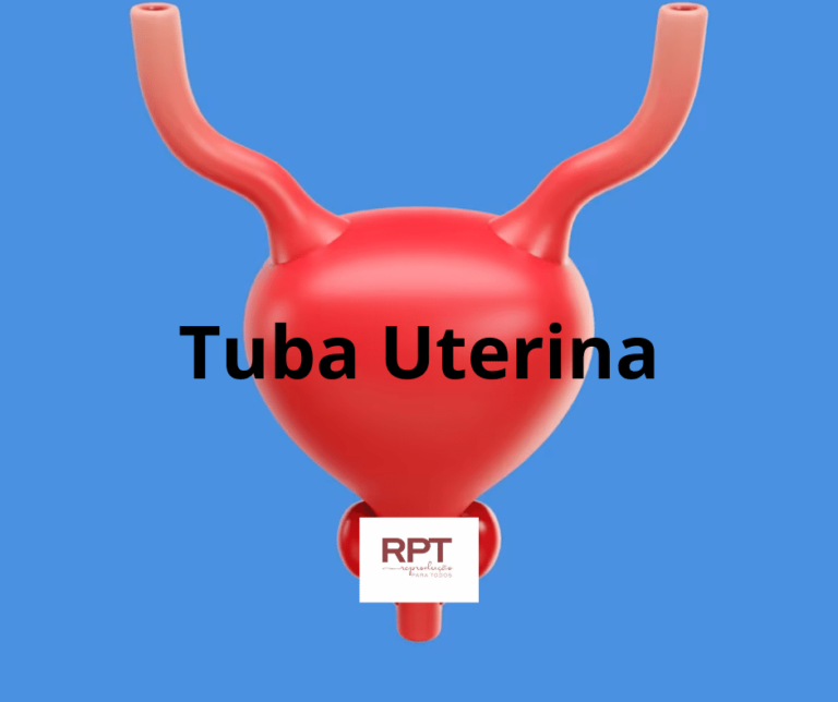Tuba Uterina: Funções, Anatomia e Papel na Reprodução - RPT ...