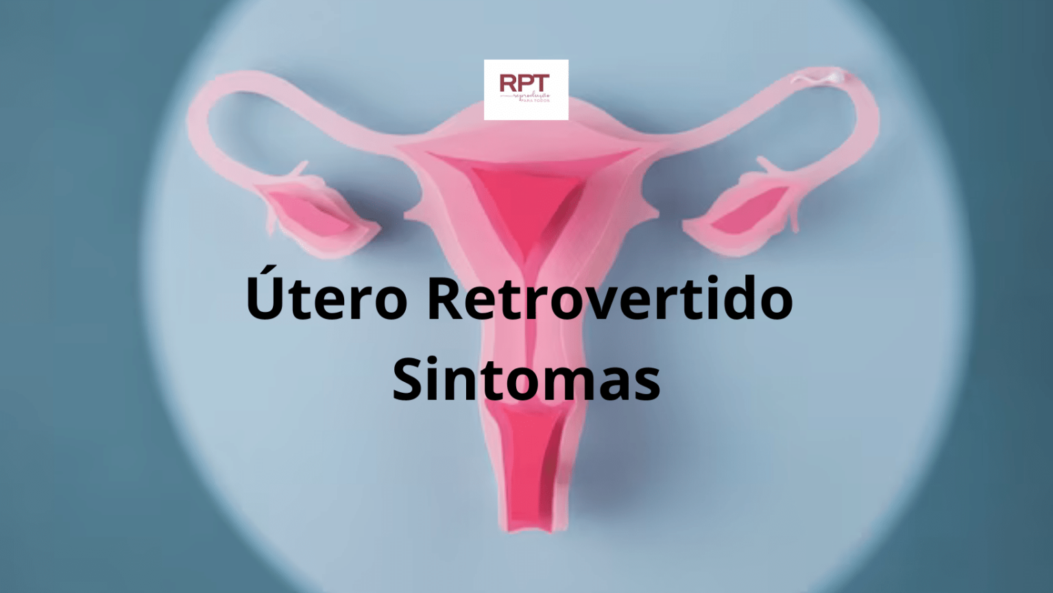 Útero Retrovertido Sintomas - RPT - Reprodução Para Todos